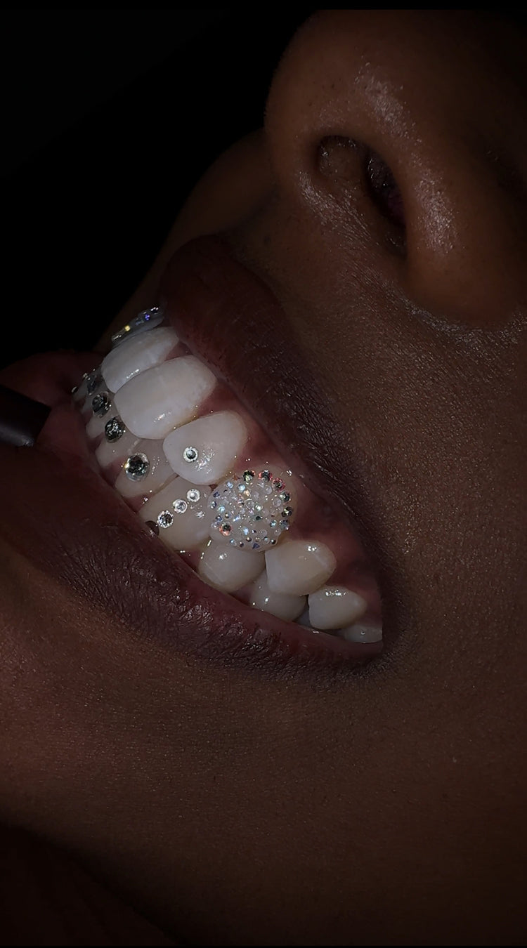 Tooth Gems – Platinum Gem Artistry